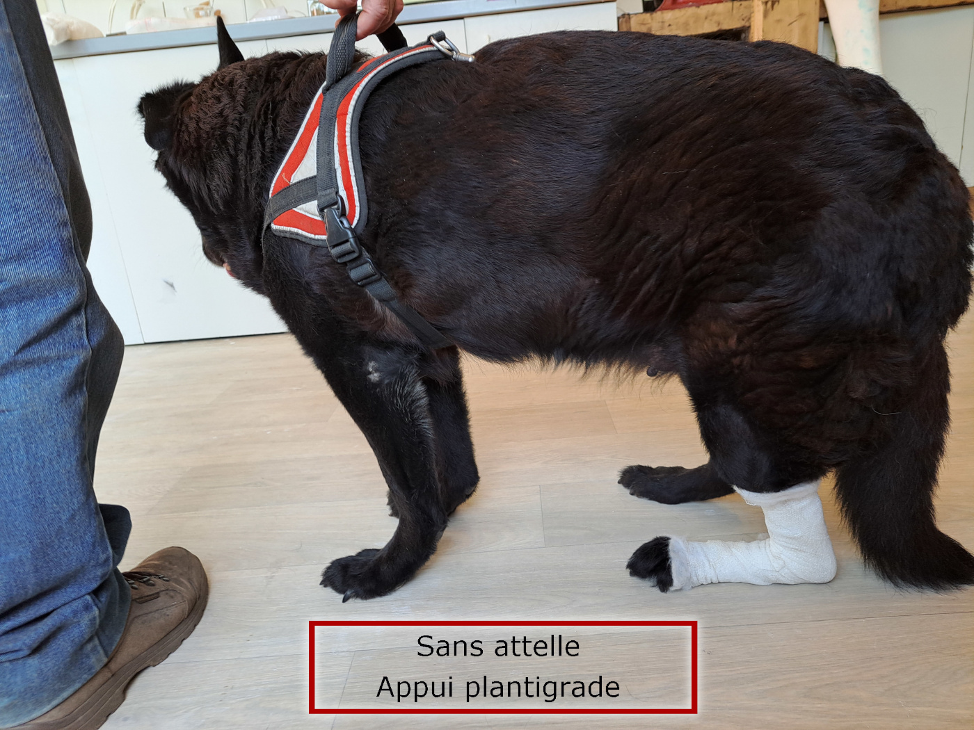 Attelle pour hyperflexion du Tarse - Orthopia-Prothèses | Prothèses ...